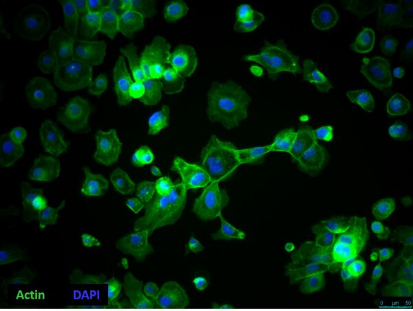 SCC-61 Human Squamous Cell Carcinoma Cell Line | SCC280